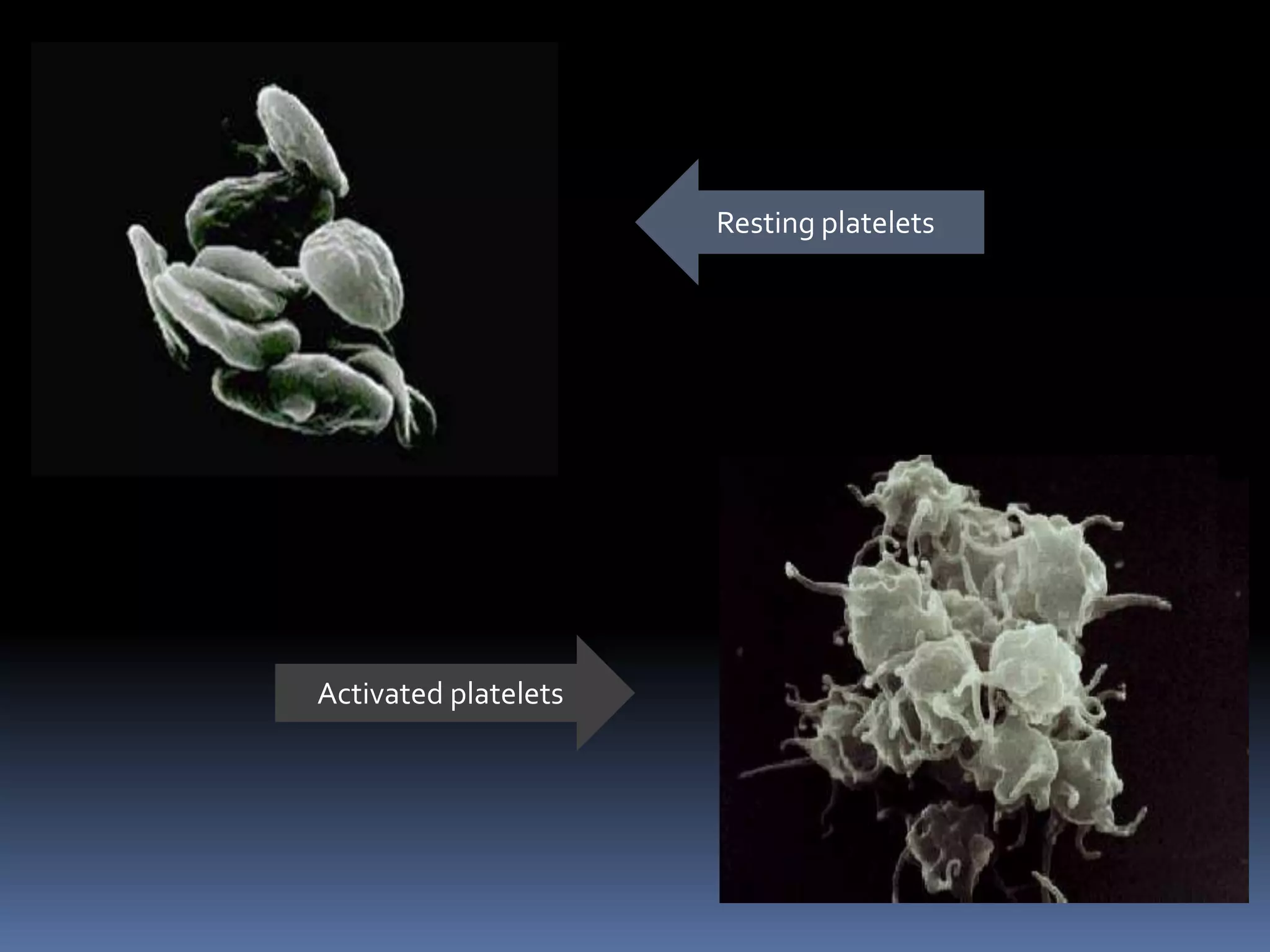 Platelet and coagulation disorder | PPTX