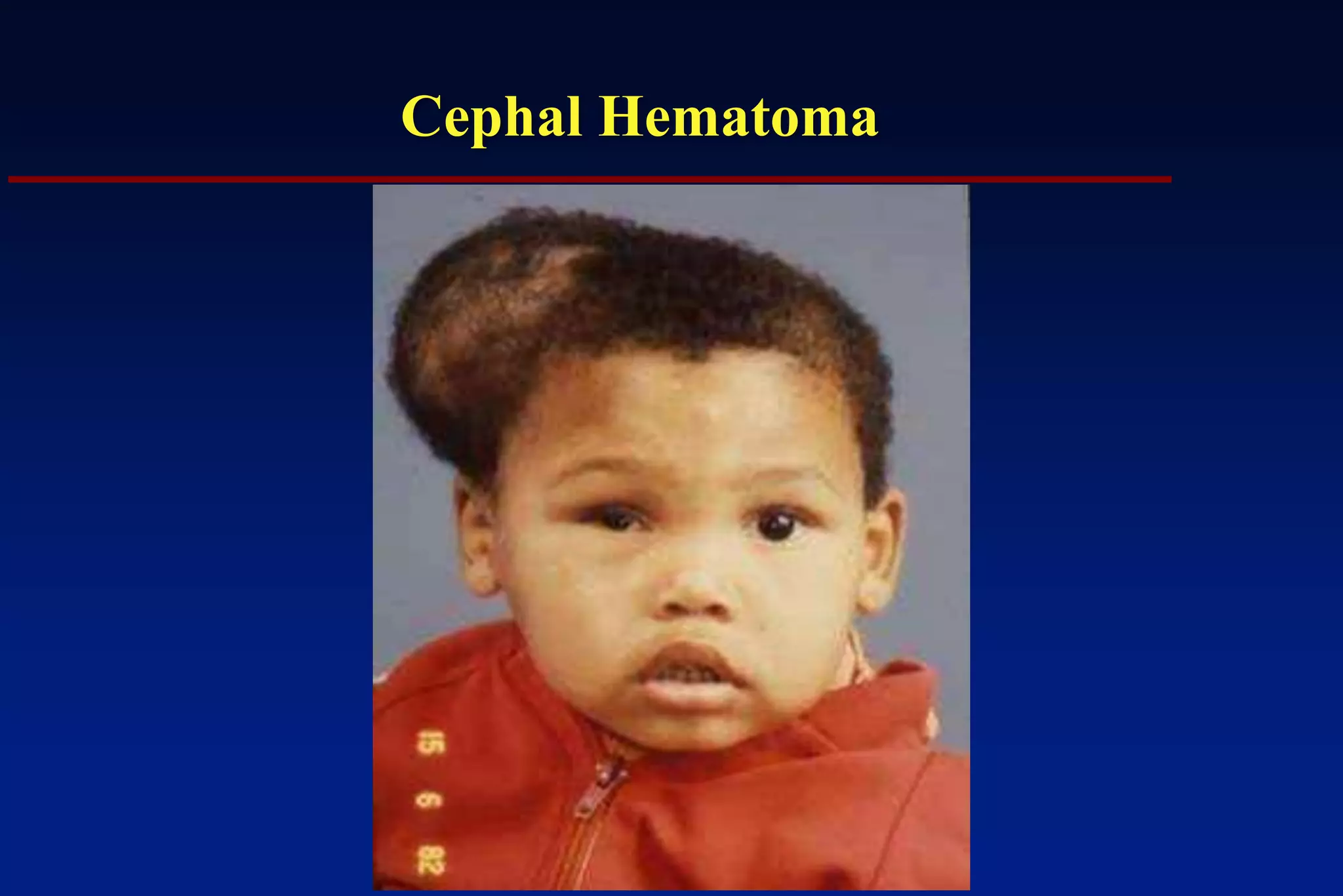 Platelet and coagulation post graduate lecture | PPTX