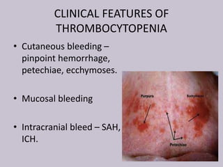 PLATELET DISORDERS.pptx