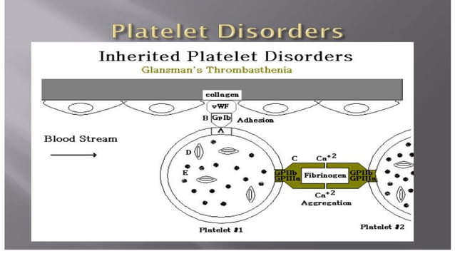 Platelet disorders in Internal medicine.pptx