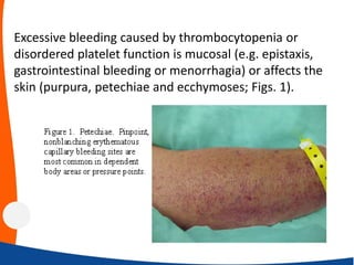Platelet disorders Haematology | PPTX