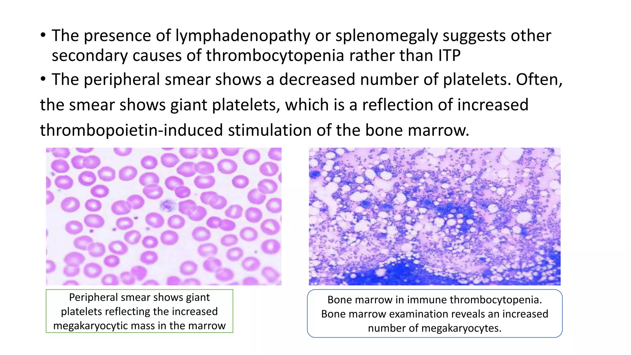 Platelet disorders summarized. ppt | PPTX