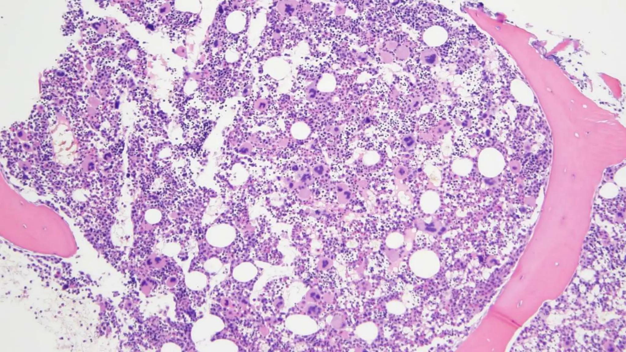 Platelet Function Disorders Assessment And Testingpptx