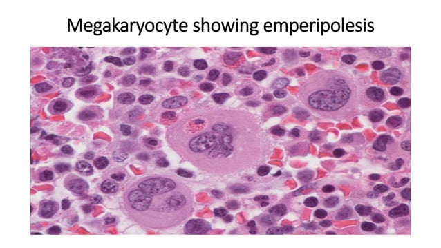 Platelet Function Disorders Assessment And Testingpptx