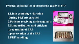 Platelet-rich fibrin (PRF) or leukocyte- and platelet-rich fibrin (L ...