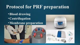 Platelet-rich fibrin (PRF) or leukocyte- and platelet-rich fibrin (L ...
