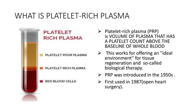 Platelet rich plasma | PPTX | Death, Injury, or Military Conflict | Sensitive Topics