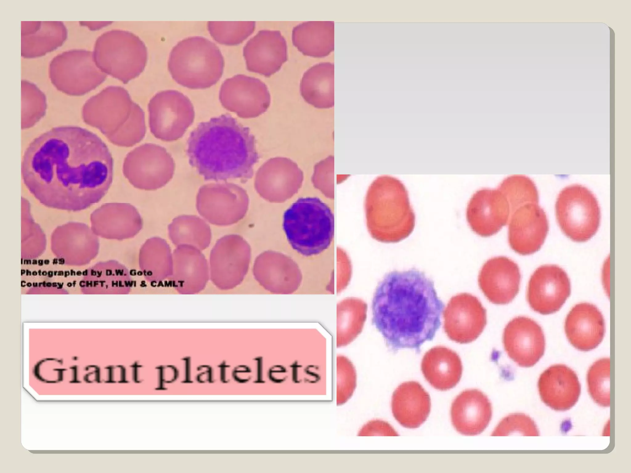 Platelets | PPT
