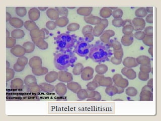 Platelets | PPT