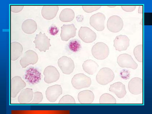 PLATELETS.ppt PLATELETS.ppt PLATELETS.ppt