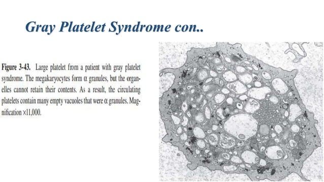 Platelet storage pool disorders | PPT | Free Download