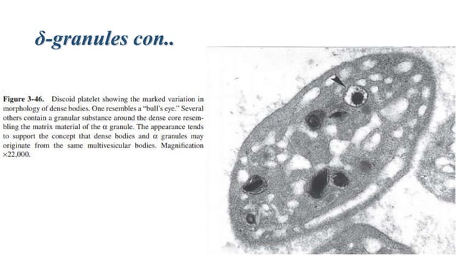 Platelet storage pool disorders | PPT