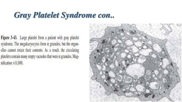 Platelet storage pool disorders