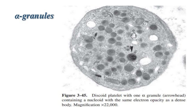 Platelet storage pool disorders