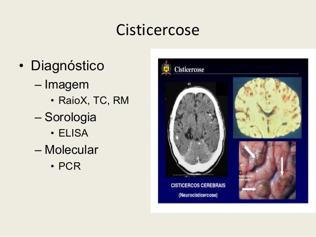 Aula de Parasitologia Médica sobre os Platelmintos