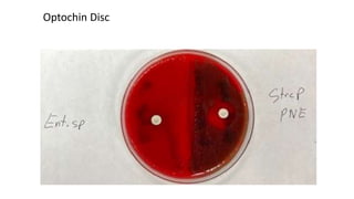Infectious Disease Plate Rounds 12-20-23.pptx
