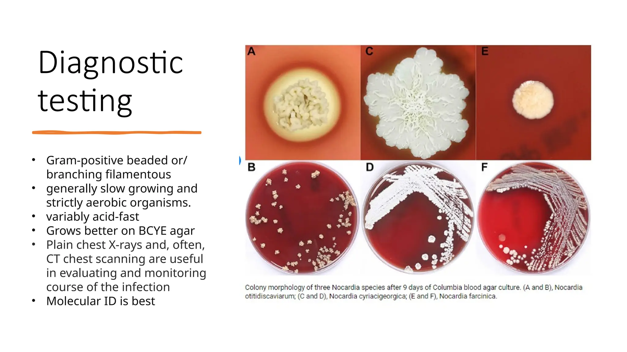 Infectious Diseases Plate Rounds 7-24-24.pptx