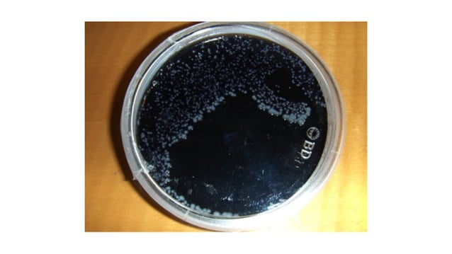 Infectious Diseases Plate Rounds 7-24-24.pptx