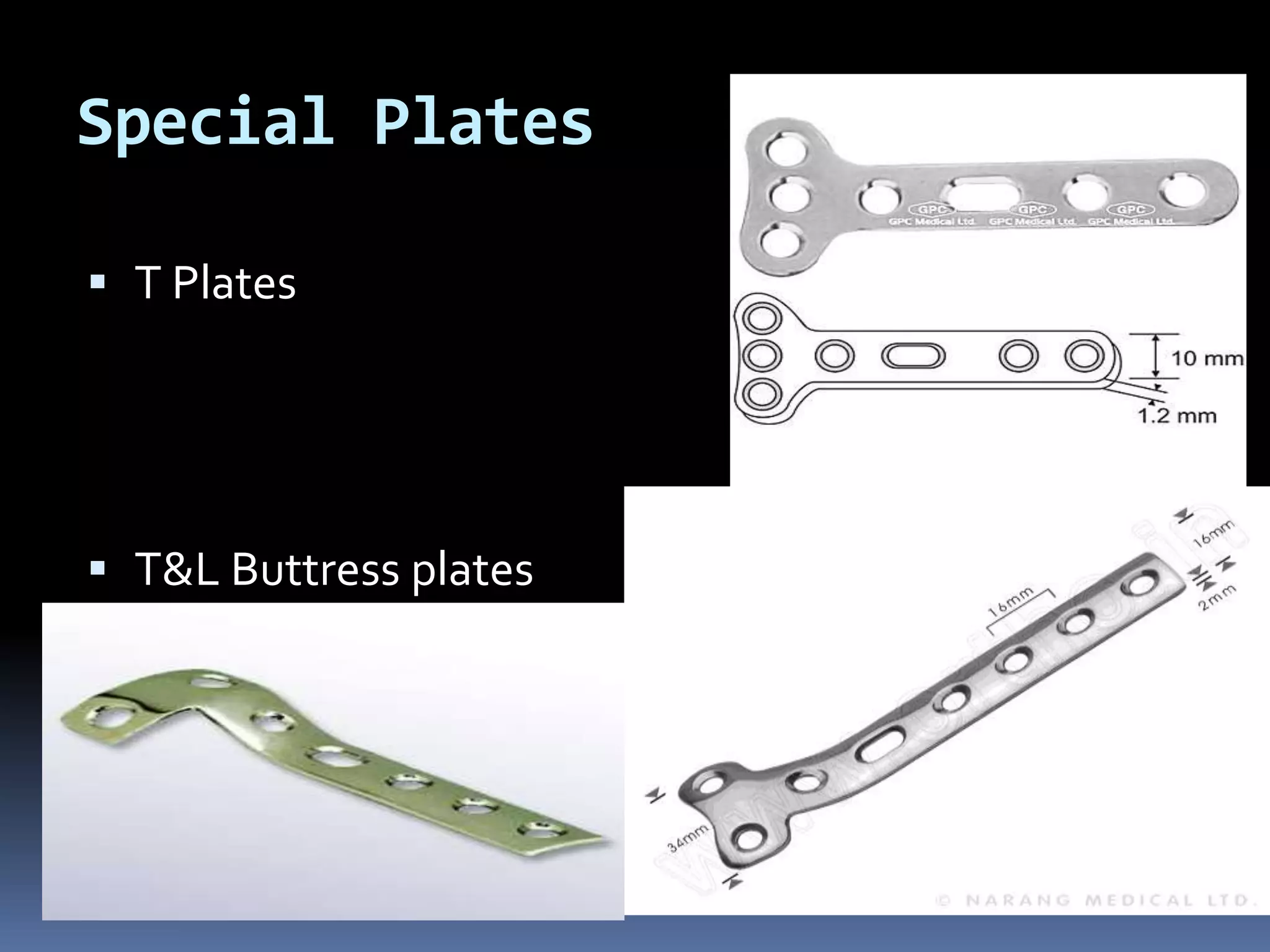 Plates and screws 11 | PPTX
