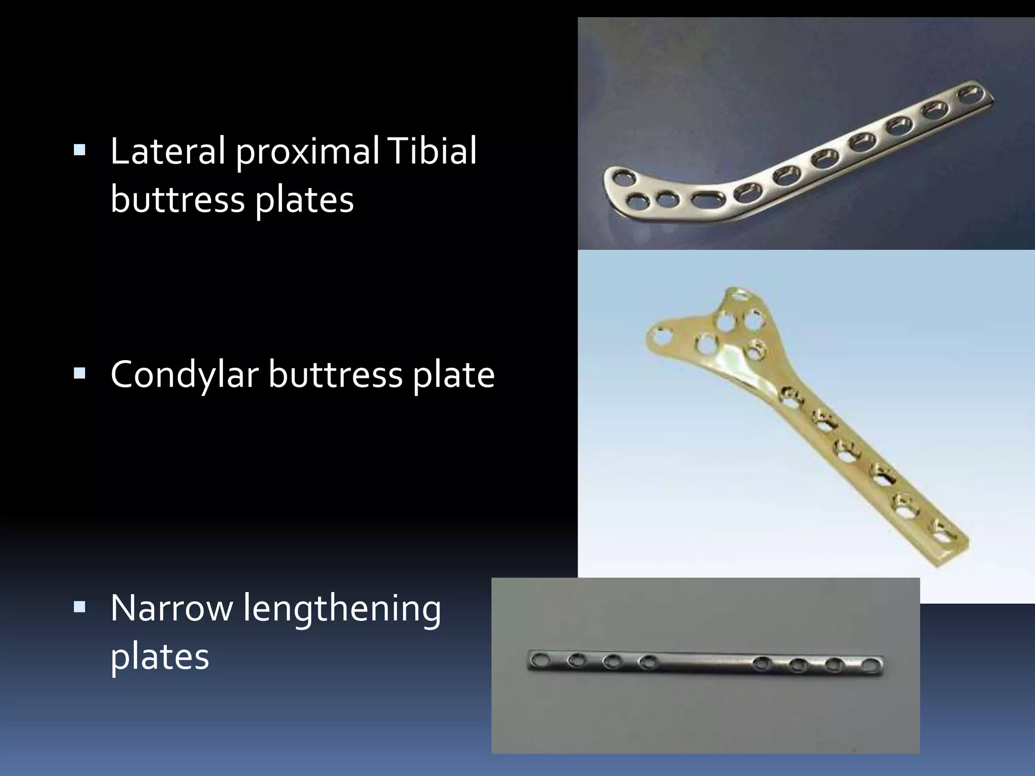 Plates and screws 11 | PPTX