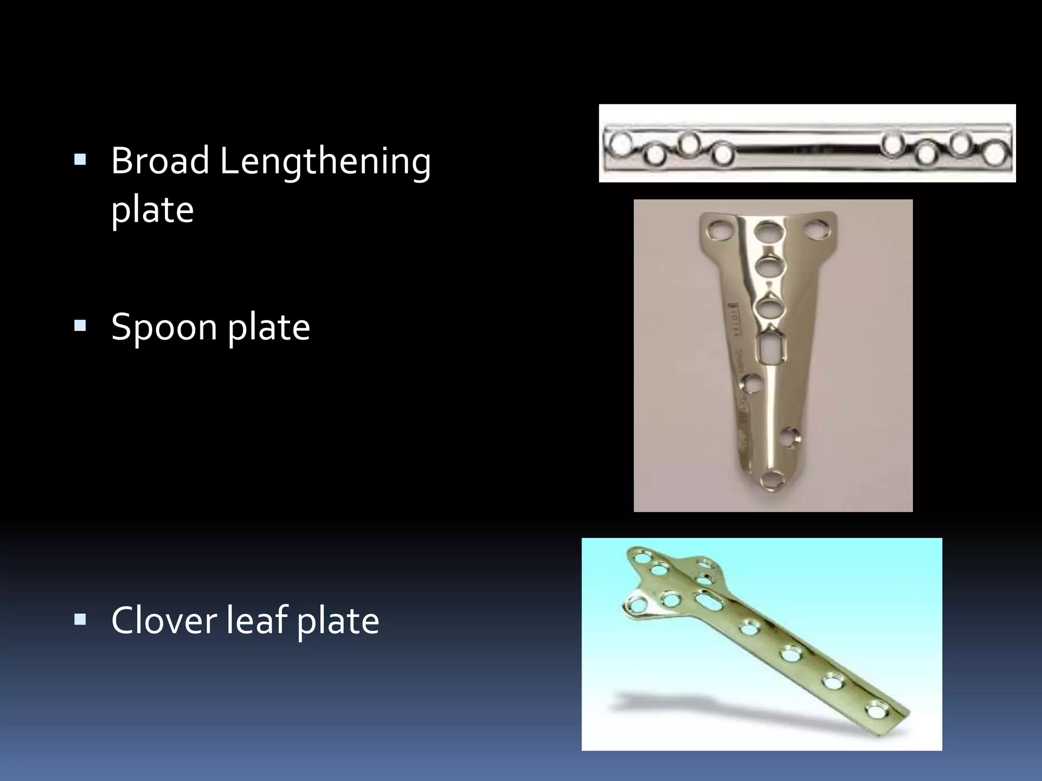Plates and screws 11 | PPTX