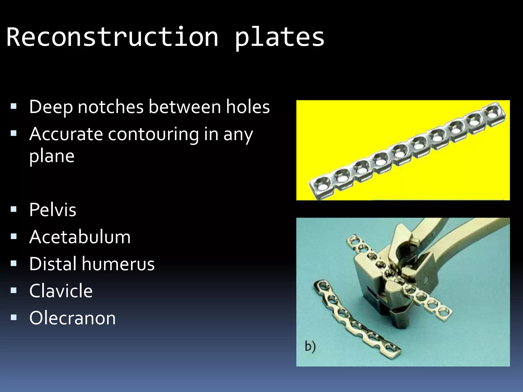 Plates and screws 11 | PPTX