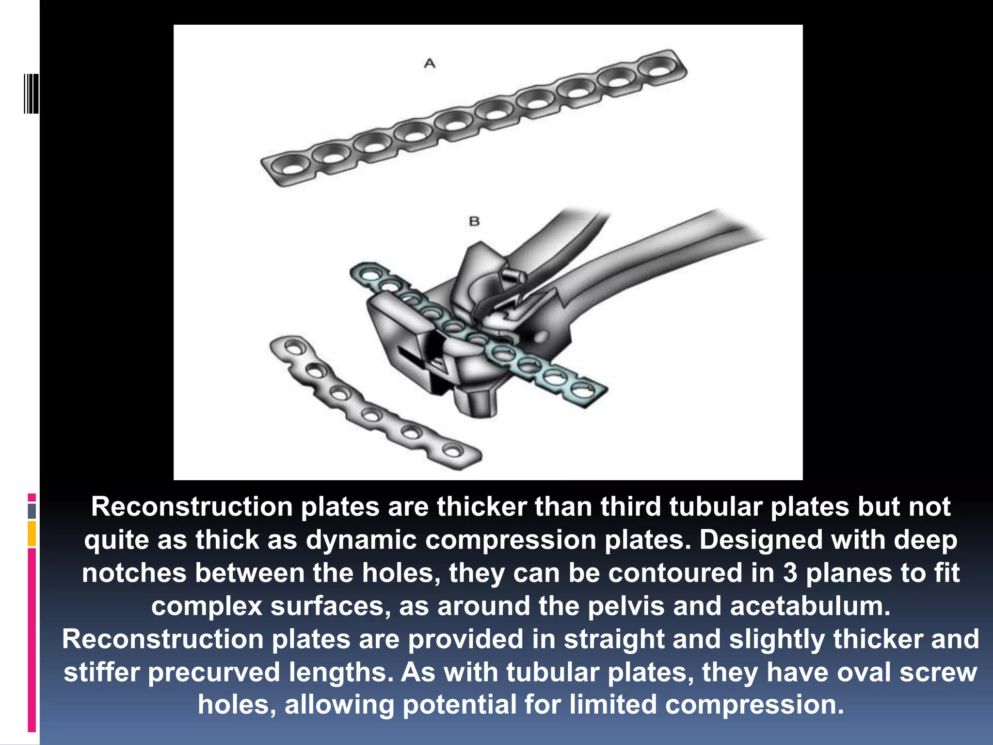 Plates and screws 11 | PPTX