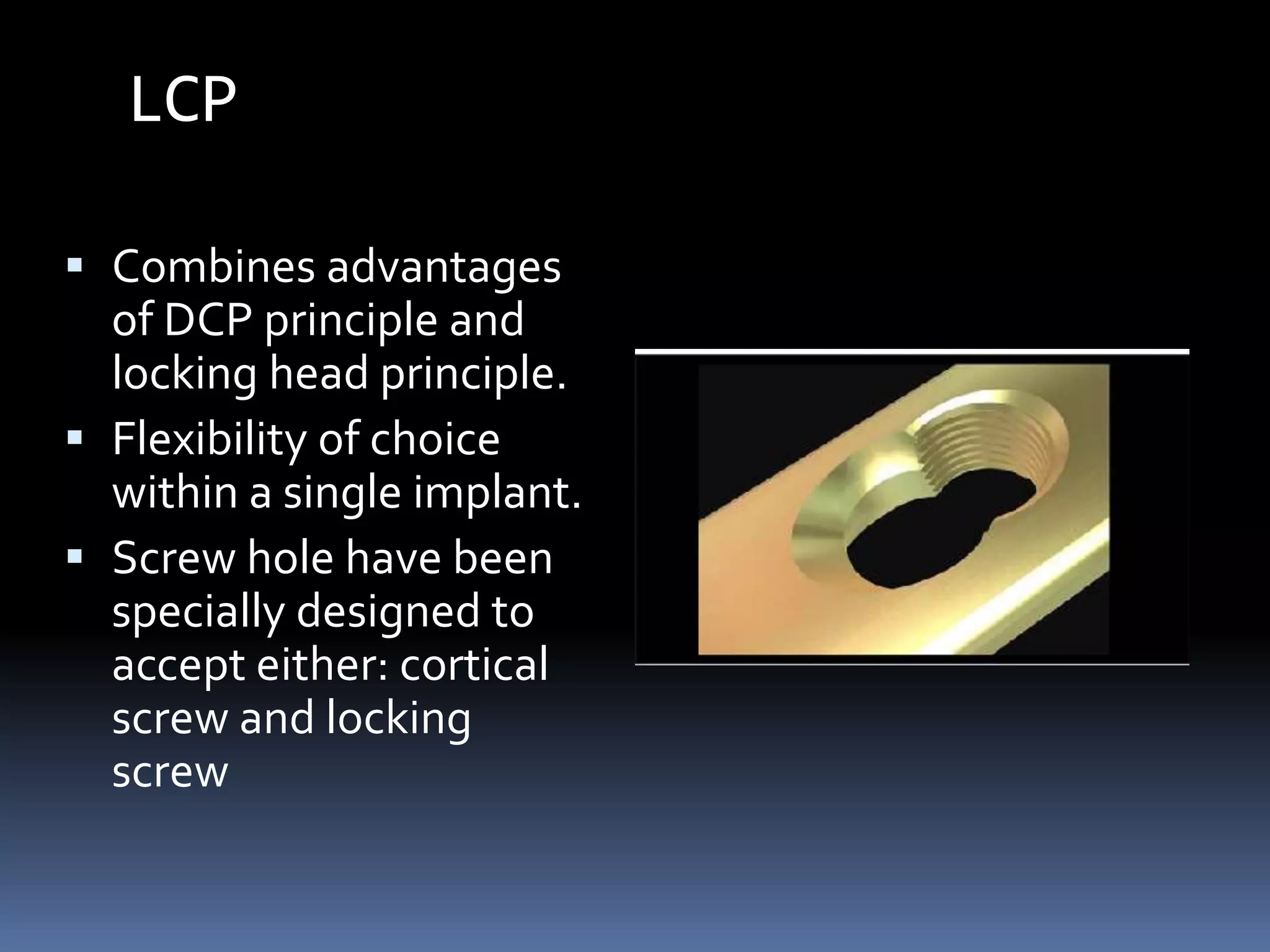 Plates and screws 11 | PPTX