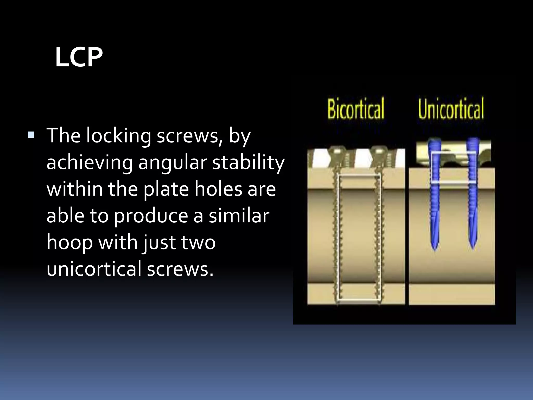 Plates and screws 11 | PPTX