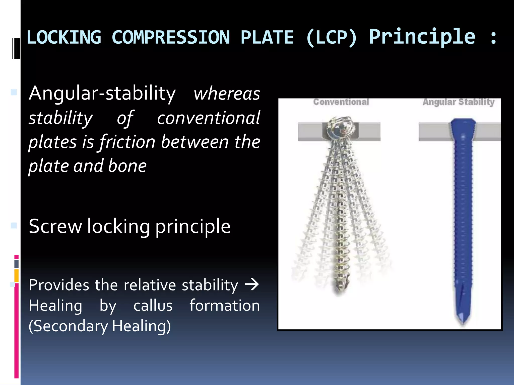 Plates and screws 11 | PPTX