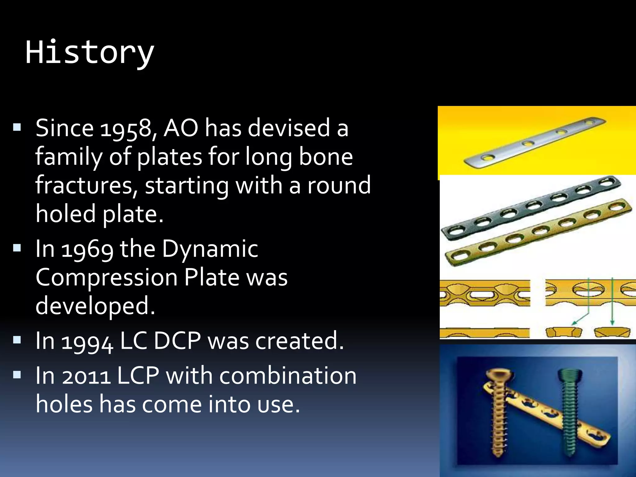 Plates and screws 11 | PPTX