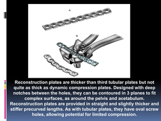 Plates and screws 11 | PPTX