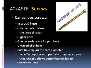 Plates and screws 11 | PPTX