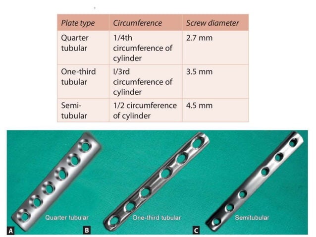 Plates in orthopaedics.pptx | First Aid | Injuries