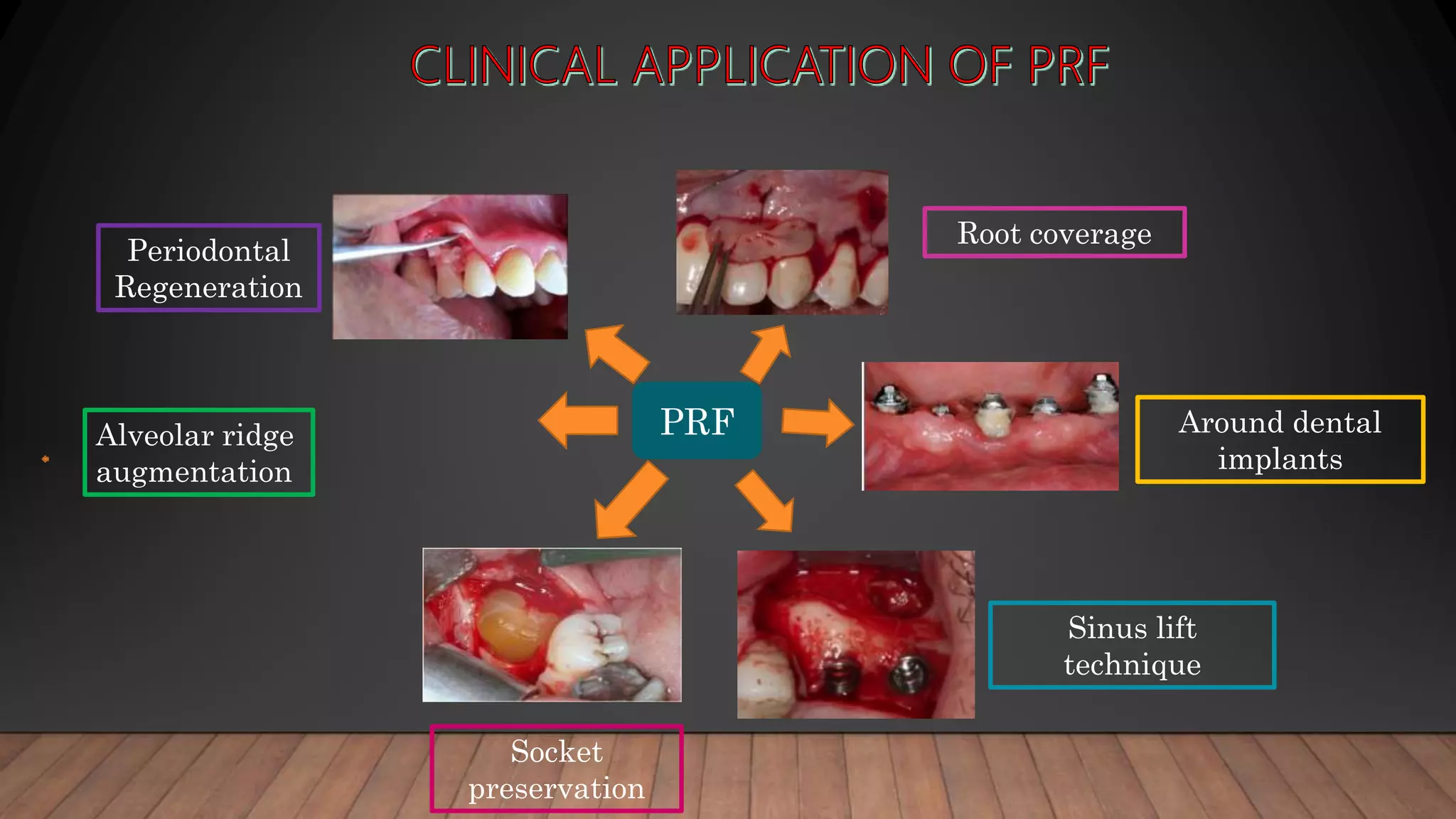 Platelet concentrates | PPTX