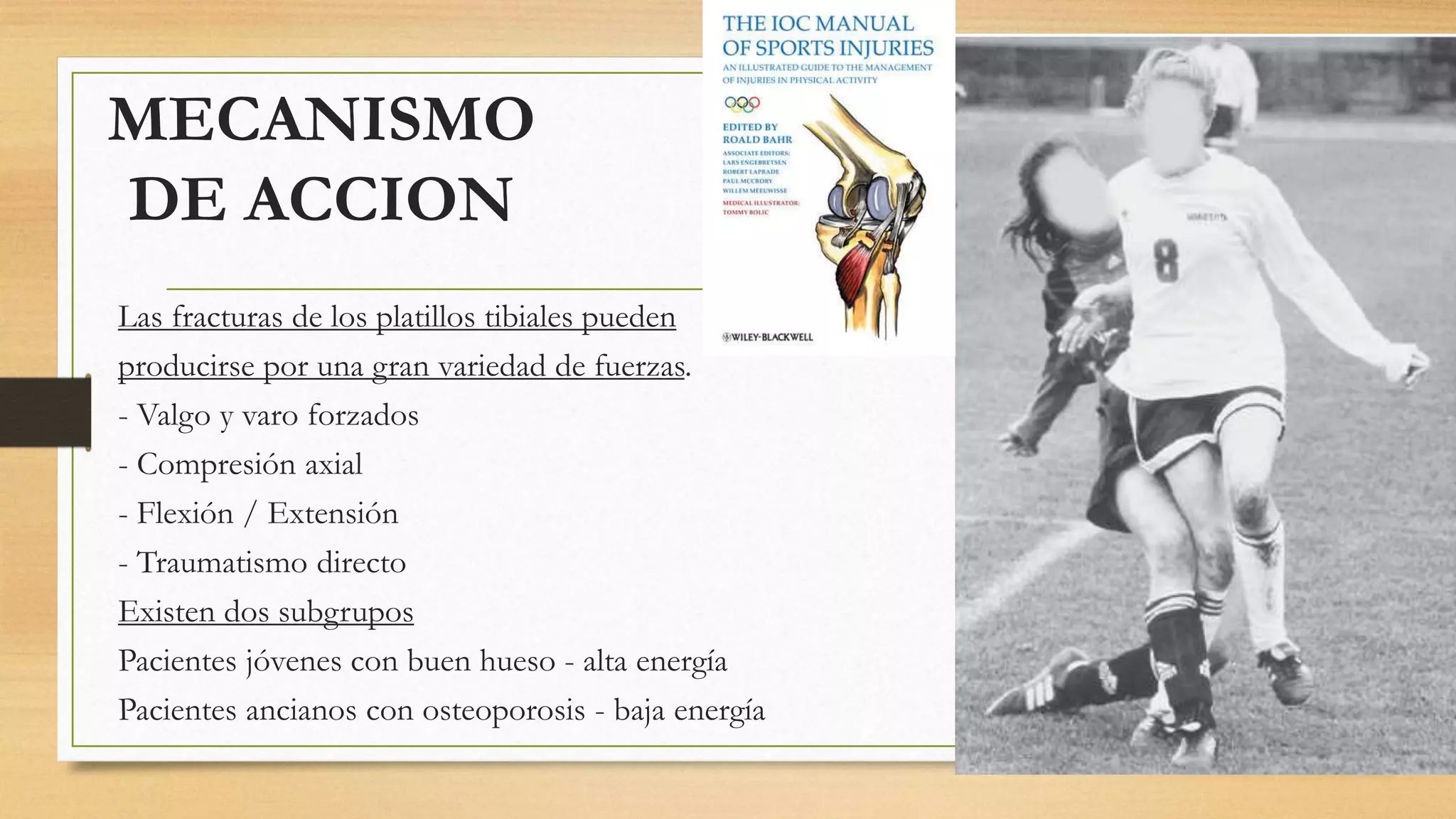 fractura de Platillo tibial | PPTX