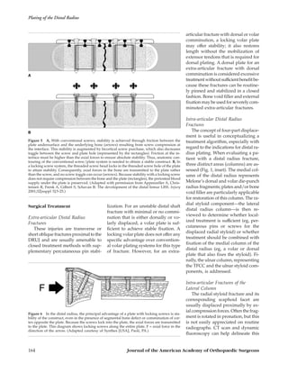 Plating of the distal radius | PDF