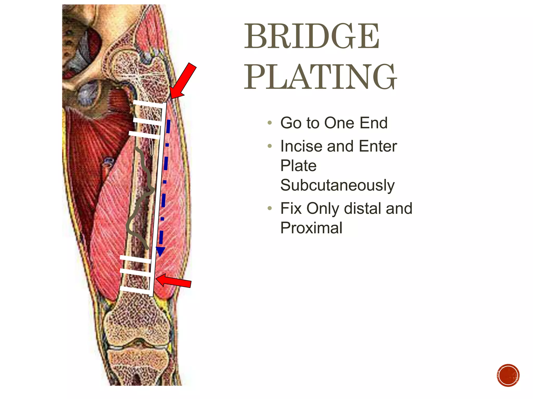 Plating PRINCIPLES RAZAK CME.pptx