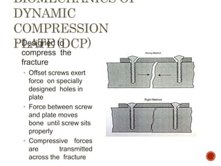 Plating PRINCIPLES RAZAK CME.pptx