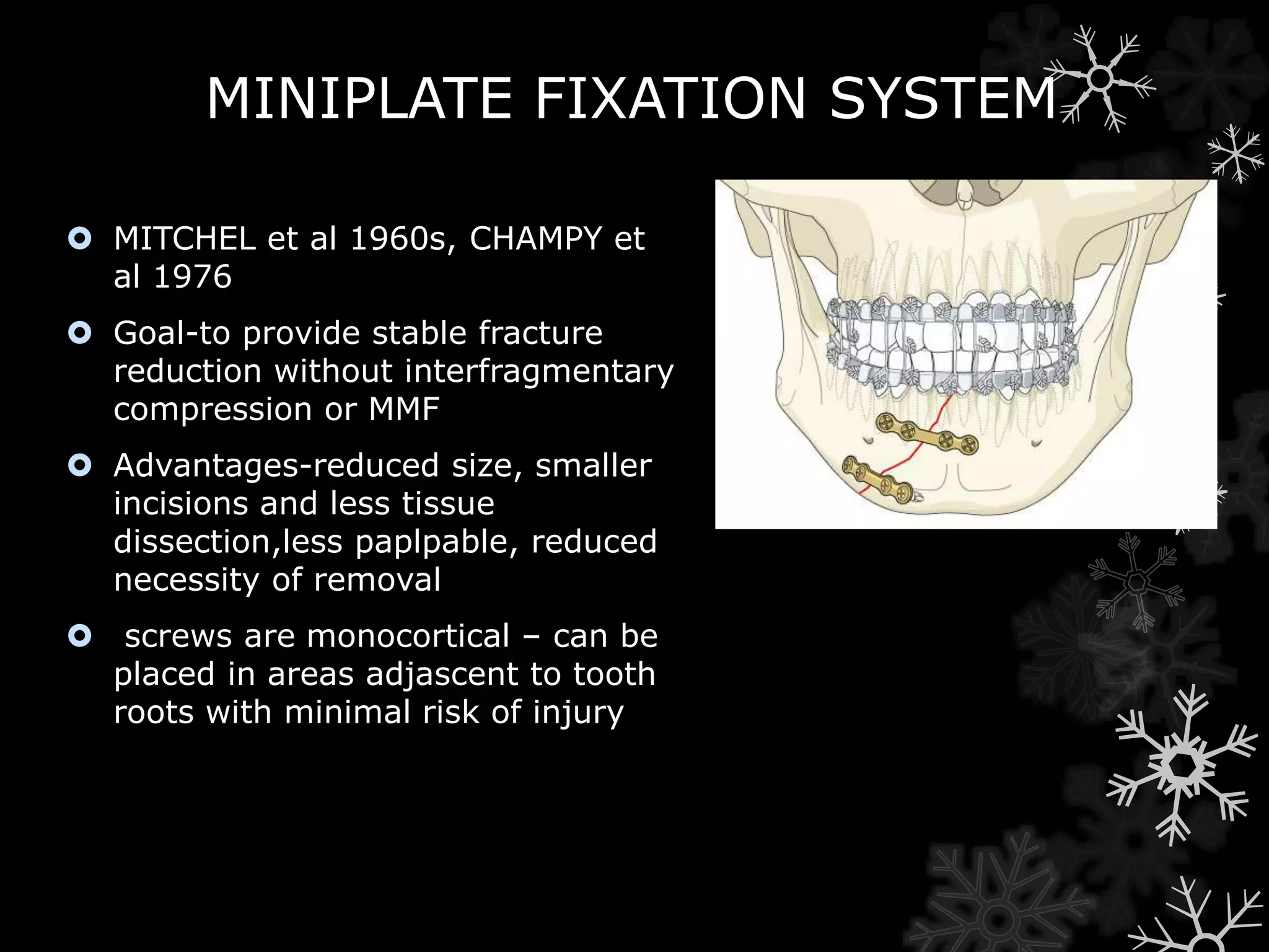Plating systems and principles of fixation in maxillofacialtrauma | PPTX