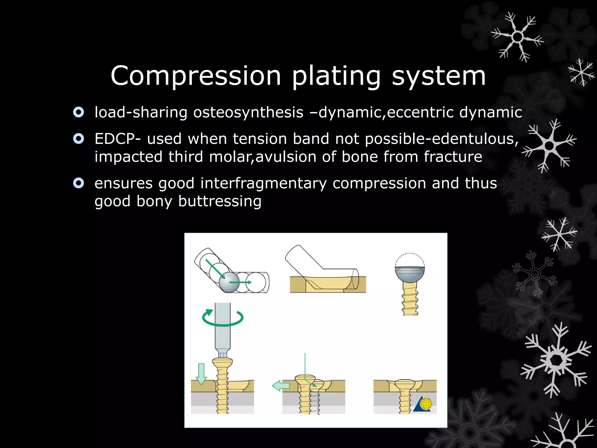 Plating systems and principles of fixation in maxillofacialtrauma | PPTX