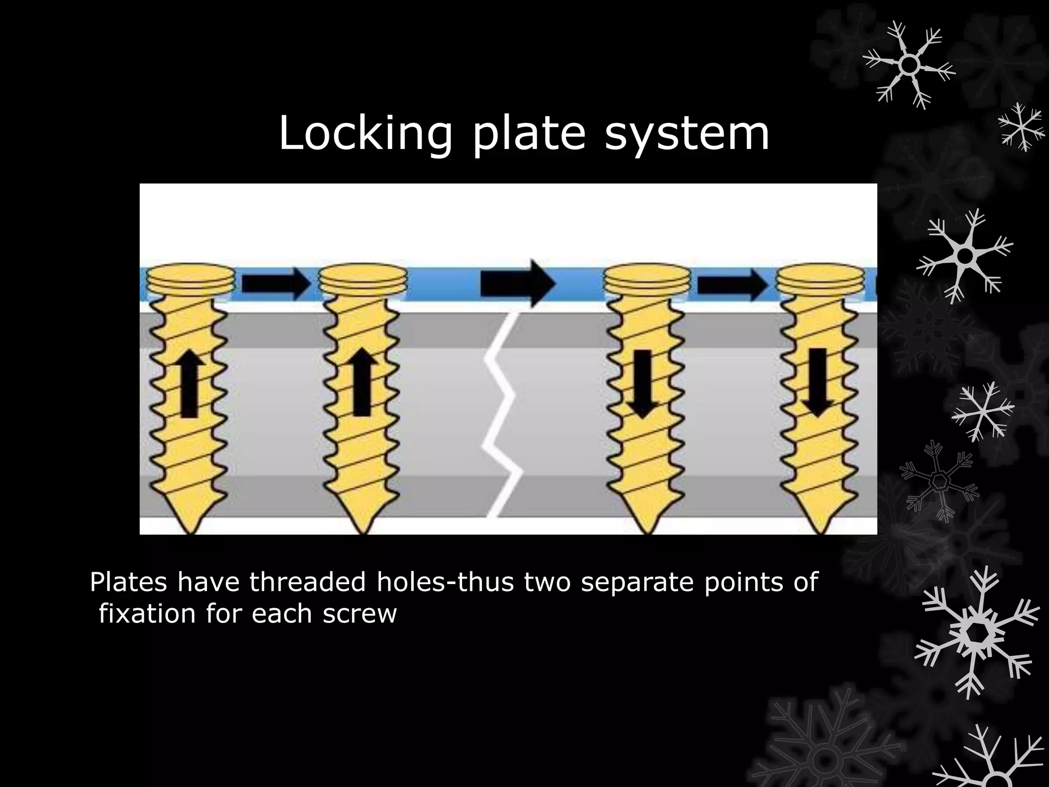 Plating systems and principles of fixation in maxillofacialtrauma | PPTX