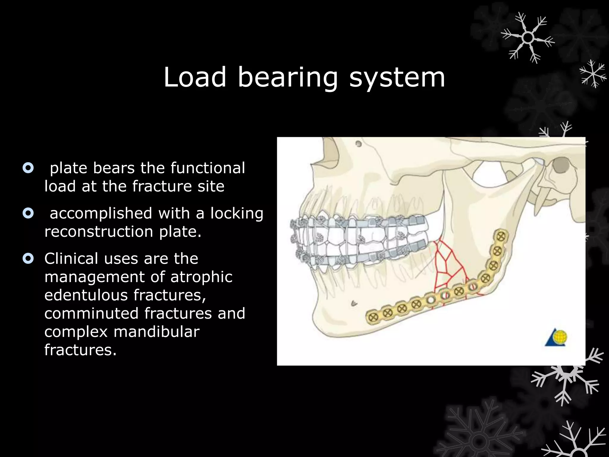 Plating systems and principles of fixation in maxillofacialtrauma | PPTX