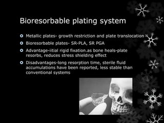 Plating systems and principles of fixation in maxillofacialtrauma | PPTX