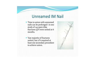 Plating tibia taif | PPTX