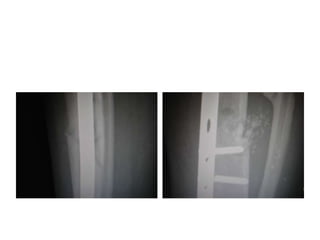 Plating tibia taif | PPTX