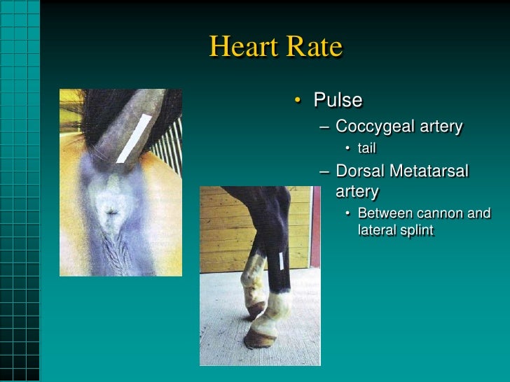 Normal Resting Values-Evaluation Techniques