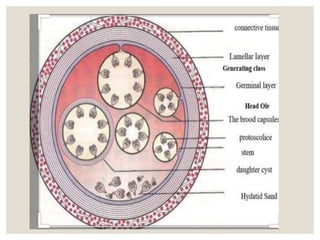 Platyhelminthes or Flatworms ( trematodes & cestodes ) | PDF