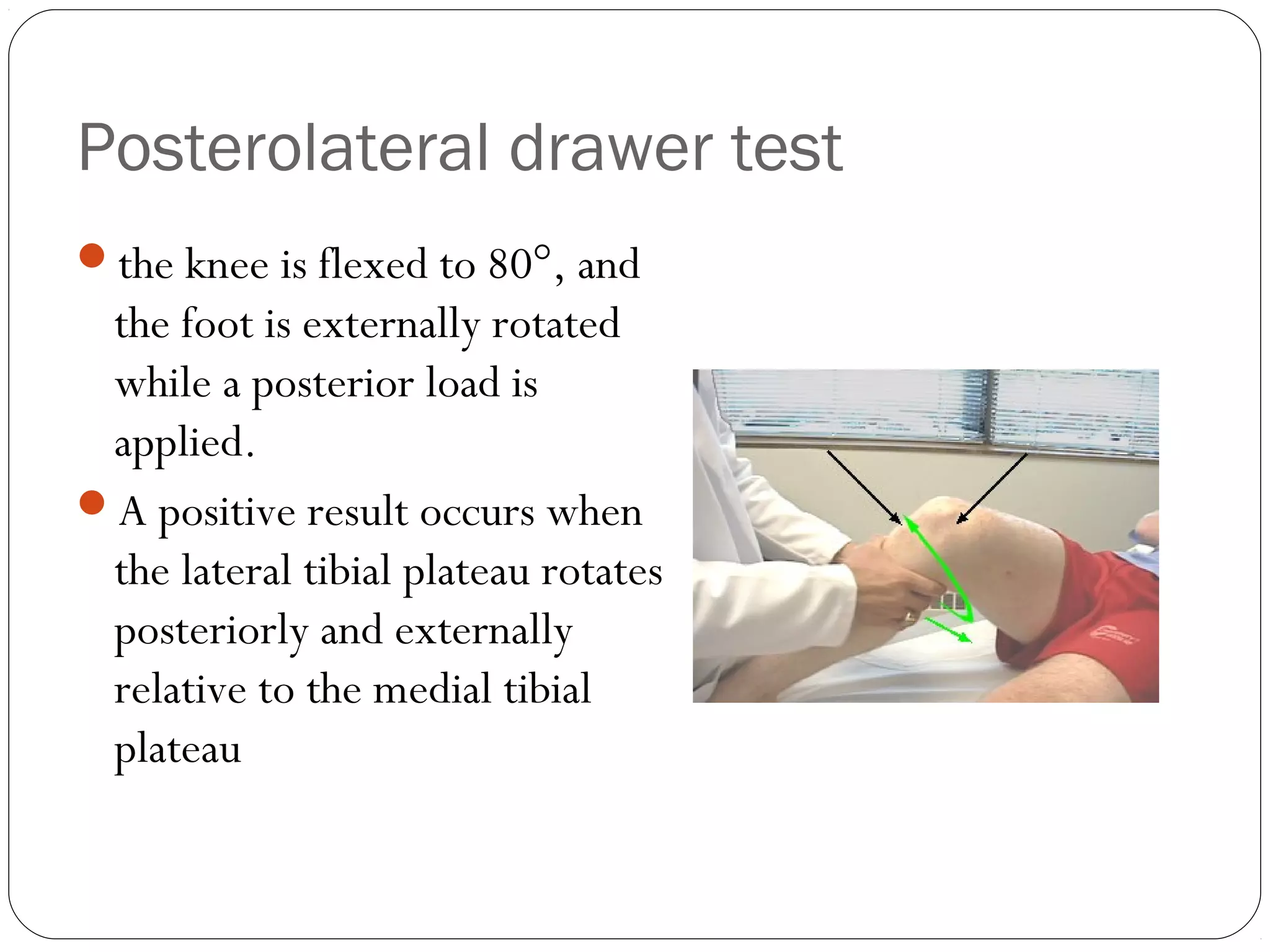 Posterolateral corner injuries of knee joint | PPT