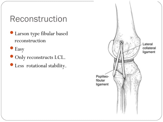 Posterolateral corner injuries of knee joint | PPT | Death, Injury, or ...